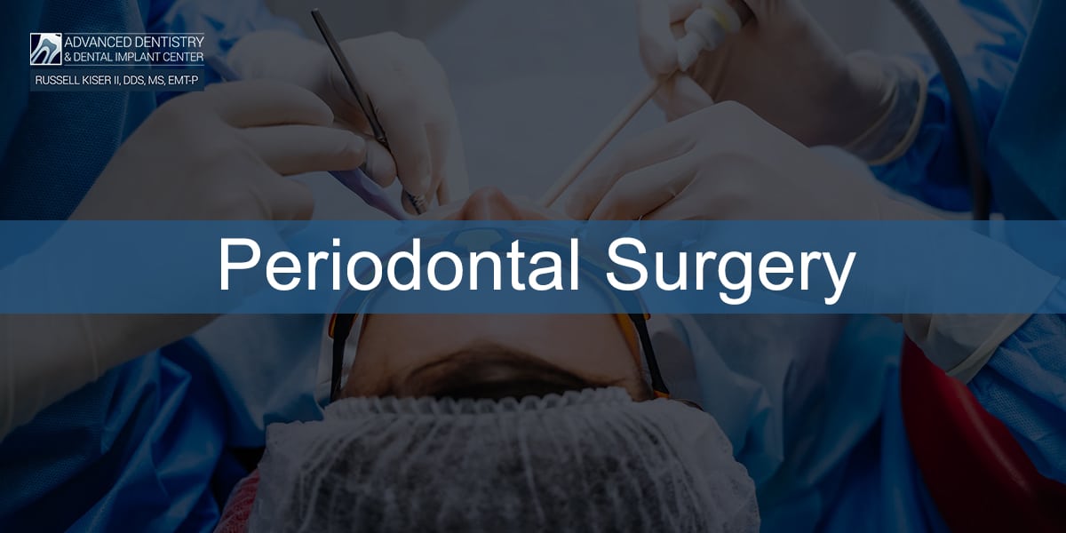 Periodontal Surgery - Advanced Dentistry & Dental Implant Center